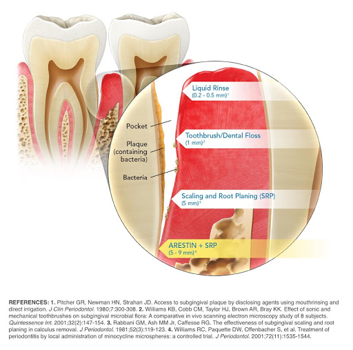 Periodontal Treatments - The Dental Center